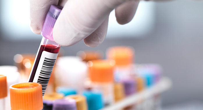 Hematologia e Hemoterapia - Hospital Pilar