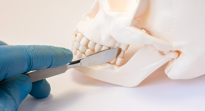 Cirurgia Bucomaxilofacial - Hospital Pilar